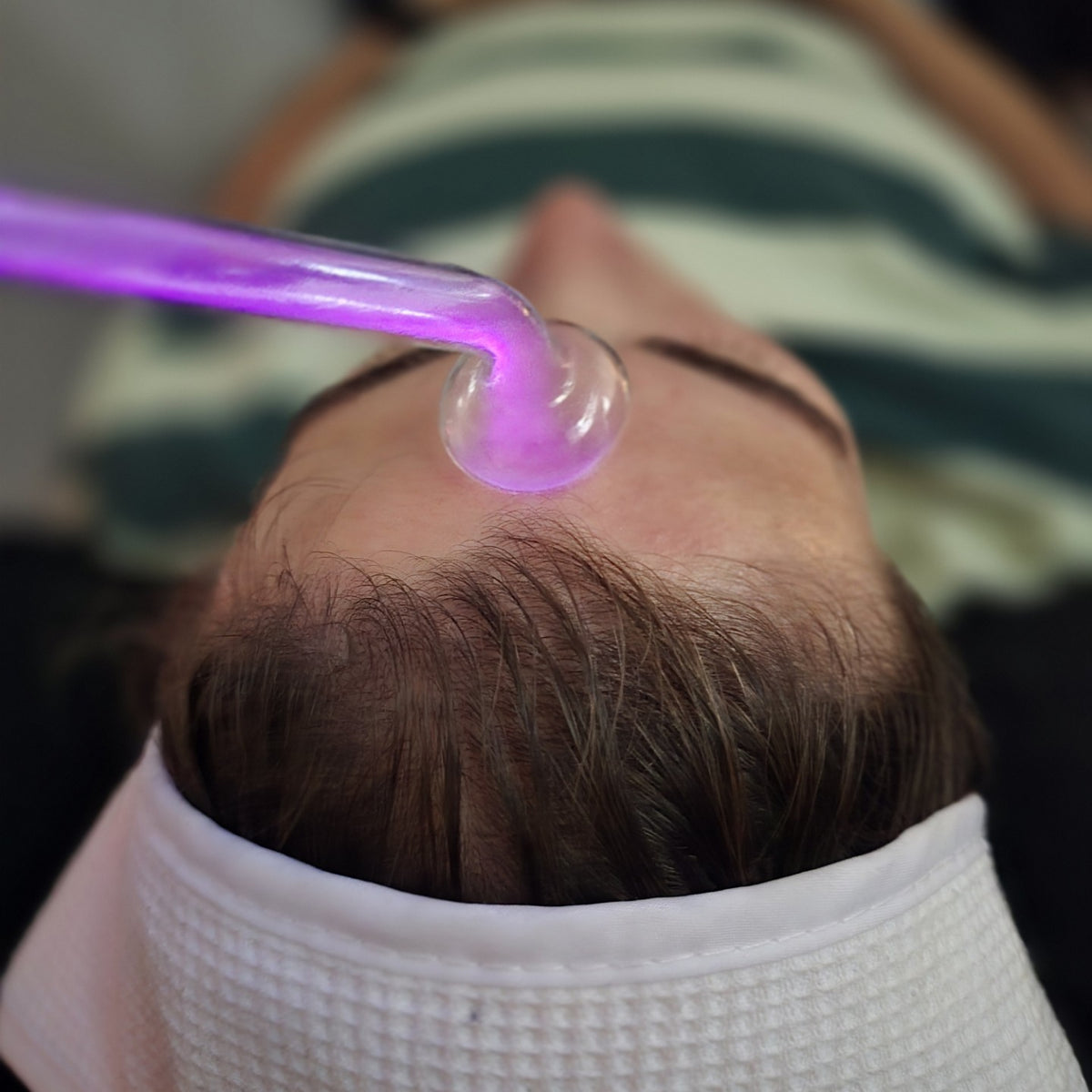 Tesla High-Frequency Hair Growth Therapy | Zen Zone Brighton – PURE ...